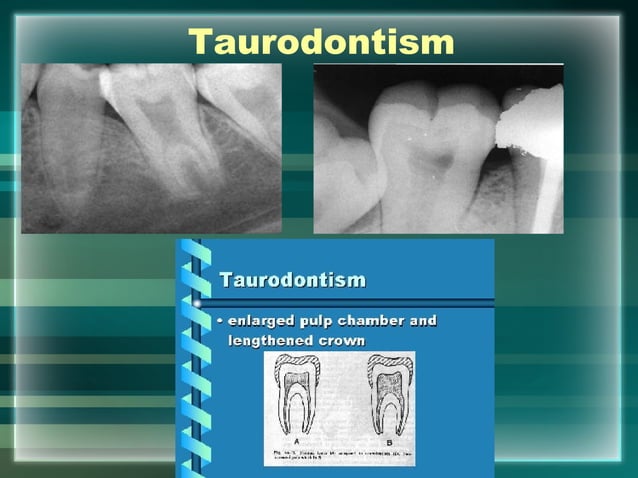 Hard Tissue Charting | PPT | Dental Health | Diseases and Conditions