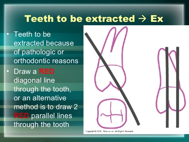 Hard Tissue Charting
