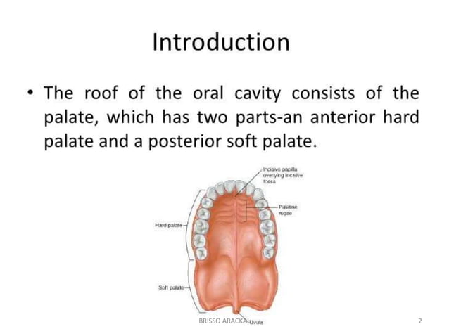 Hard and soft palate | PPTX