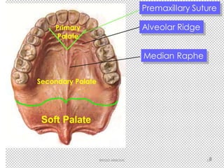 Hard And Soft Palate Diagram