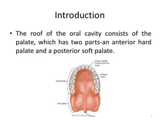 Hard Palate Diagram