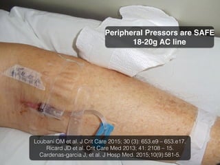 Vasopressors in the Emergency room by John Greenwood | PPT