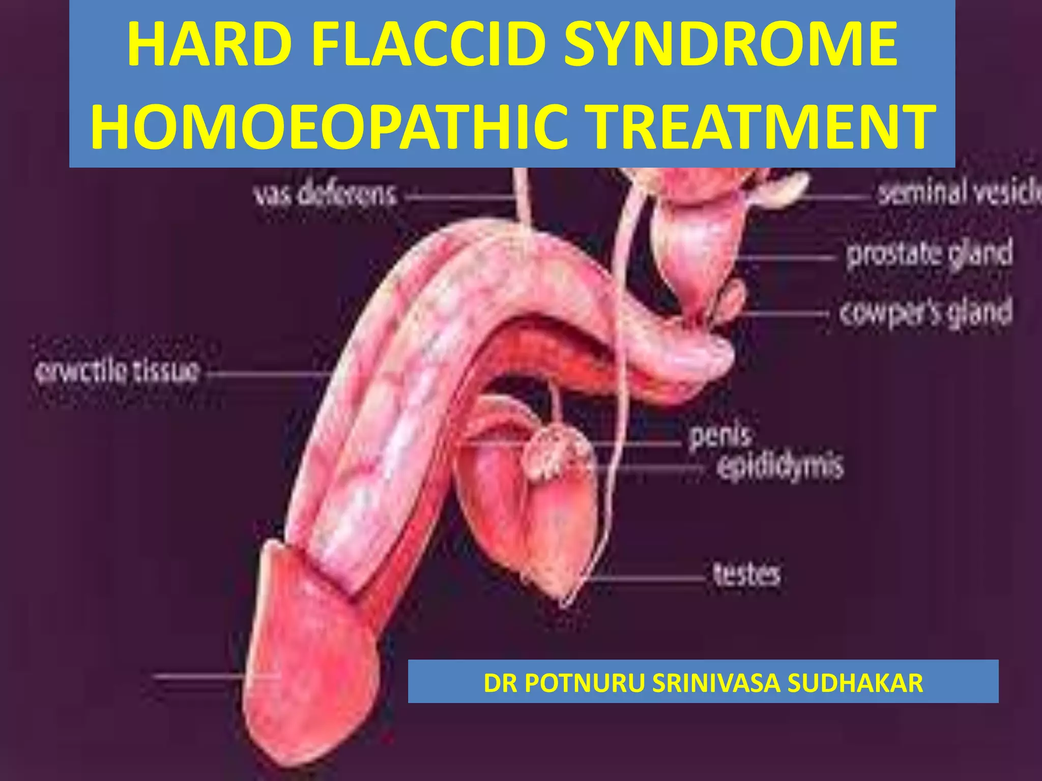Hard Flaccid Syndrome Homoeopathic Treatment Pptx