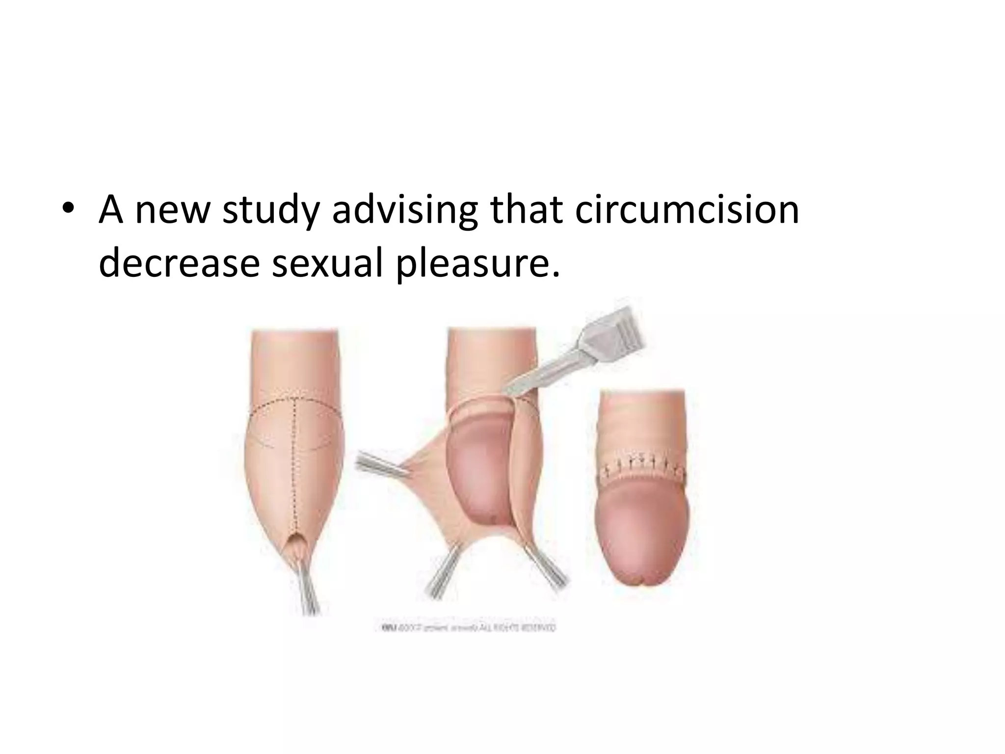 Hard Flaccid Syndrome Homoeopathic Treatment Pptx