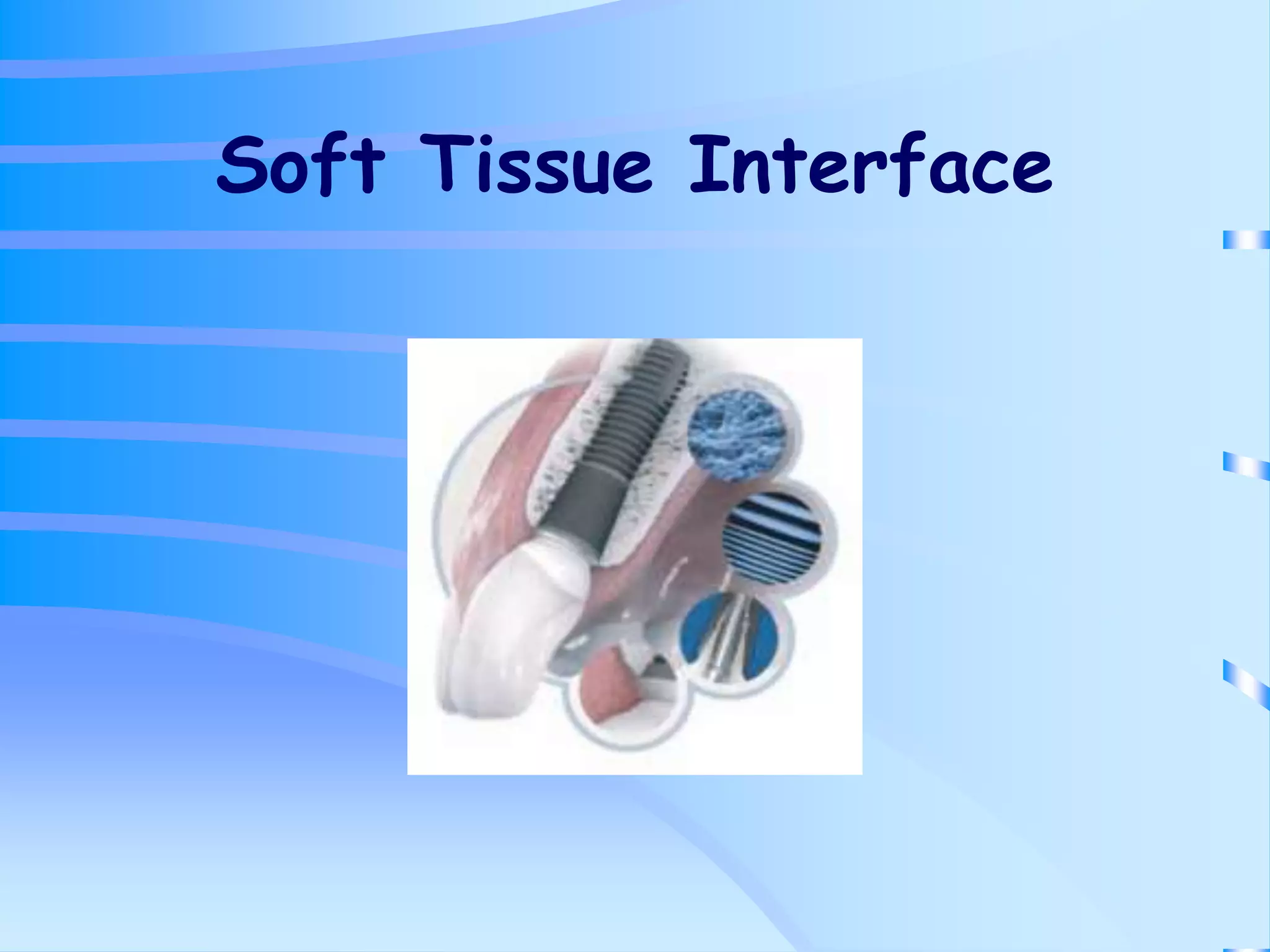Hard & Soft Tissue IMplant Interface .ppt