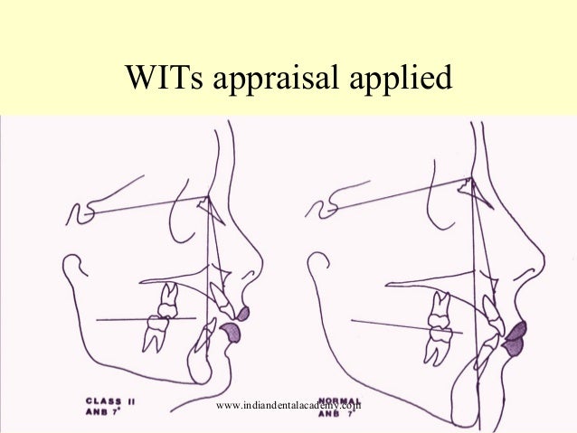 Hard tissue cephalometric analysis