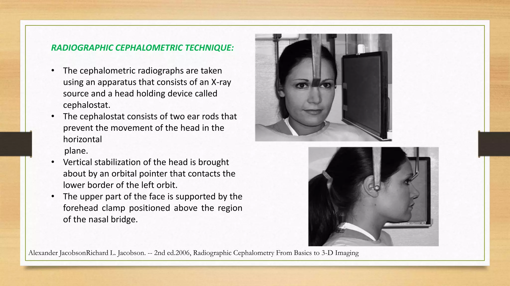 HARD TISSUE CEPHALOMETRIC ANALYSIS.pptx