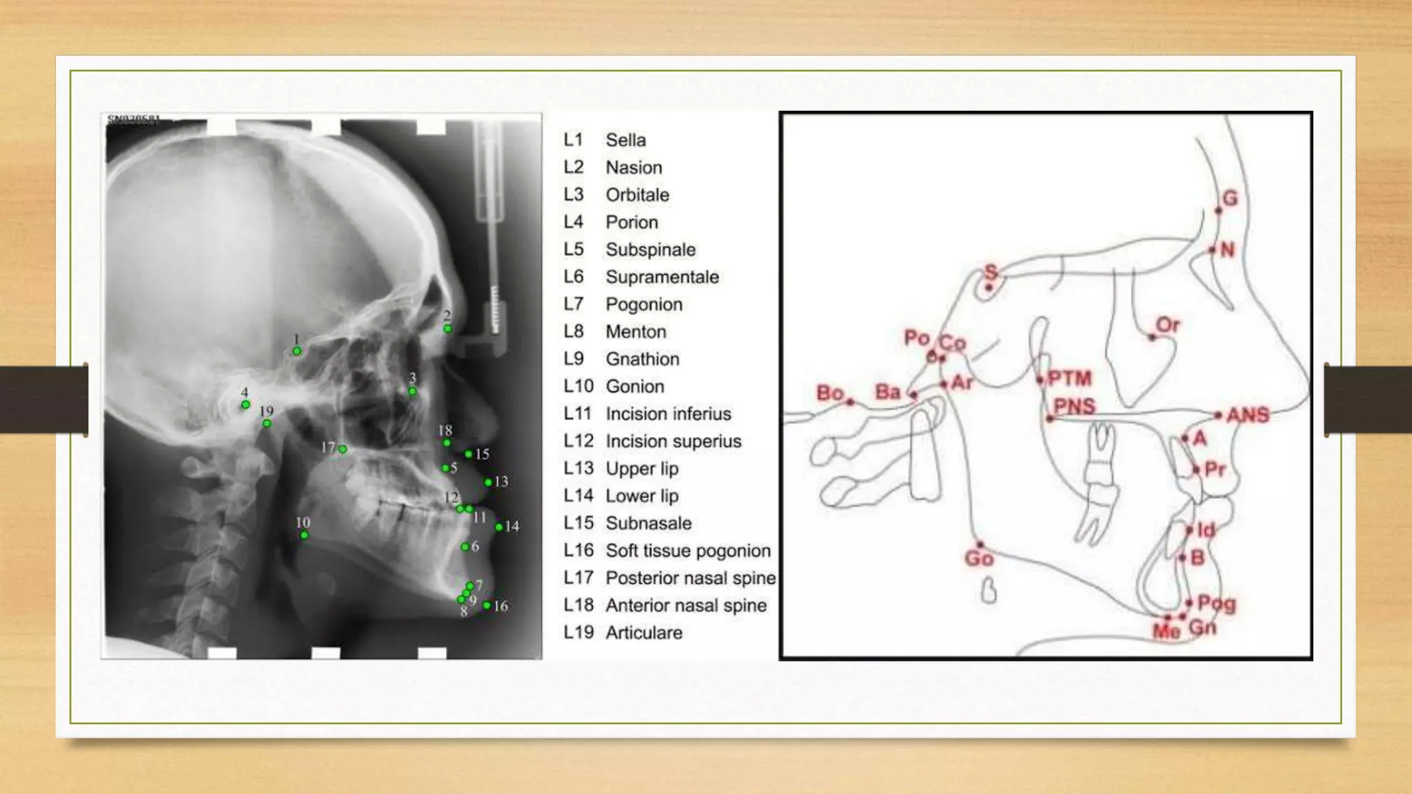 HARD TISSUE CEPHALOMETRIC ANALYSIS.pptx