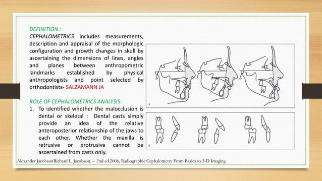 HARD TISSUE CEPHALOMETRIC ANALYSIS.pptx | Dental Health | Diseases and Conditions