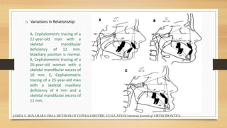 HARD TISSUE CEPHALOMETRIC ANALYSIS.pptx