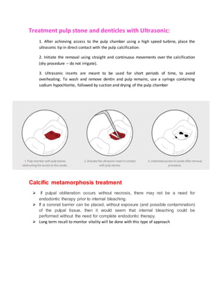 Hard tissue changes within the pulp | DOCX | Dental Health | Diseases ...