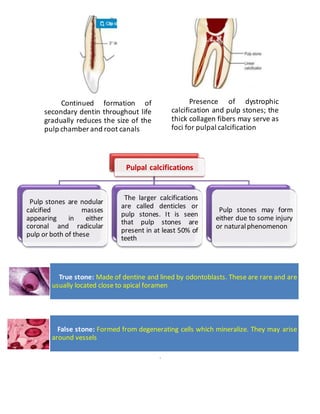 Hard tissue changes within the pulp | DOCX | Dental Health | Diseases ...