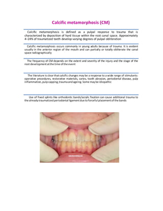 Hard tissue changes within the pulp | DOCX | Dental Health | Diseases ...
