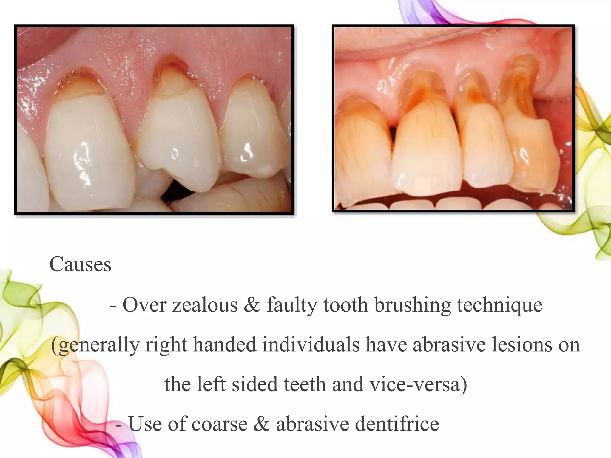 Hard Tissue examination, Diag & trtmnt plan.pptx