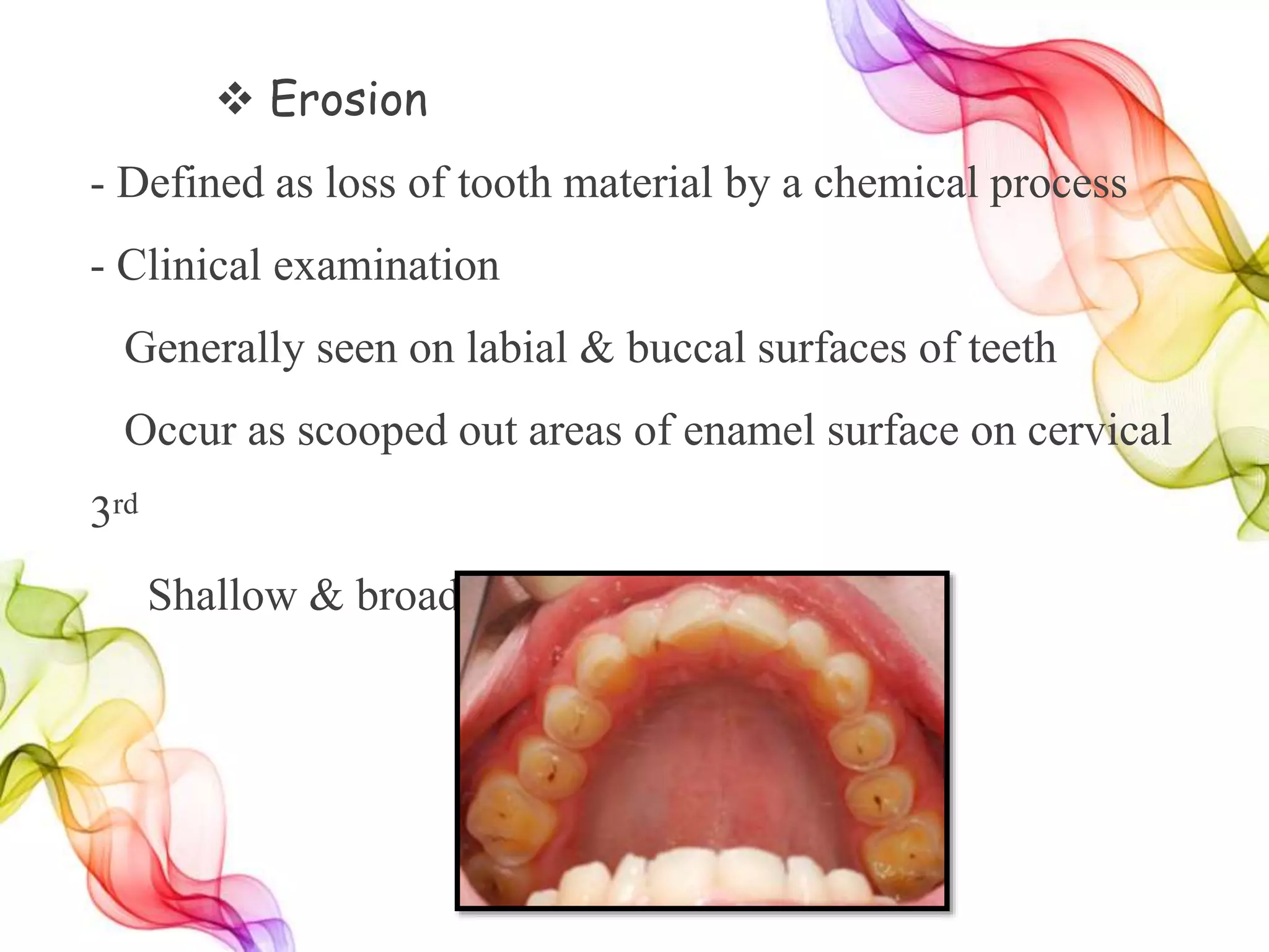 Hard Tissue examination, Diag & trtmnt plan.pptx