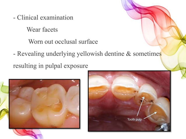 Hard Tissue examination, Diag & trtmnt plan.pptx | Dental Health ...