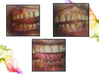 Hard Tissue examination, Diag & trtmnt plan.pptx