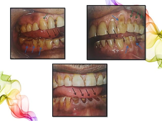 Hard Tissue examination, Diag & trtmnt plan.pptx | Dental Health ...