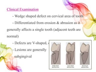 Hard Tissue examination, Diag & trtmnt plan.pptx