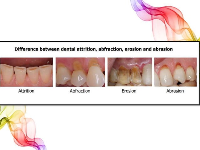 Hard Tissue examination, Diag & trtmnt plan.pptx | Dental Health ...