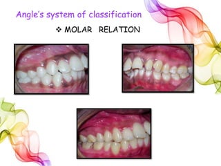 Hard Tissue examination, Diag & trtmnt plan.pptx | Dental Health ...
