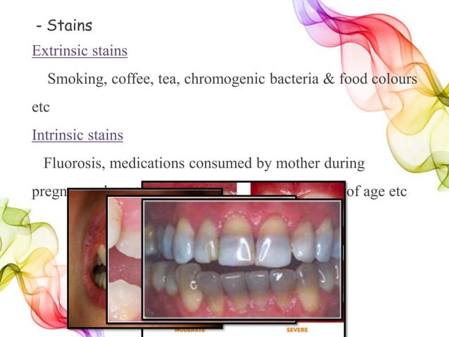 Hard Tissue examination, Diag & trtmnt plan.pptx | Dental Health ...