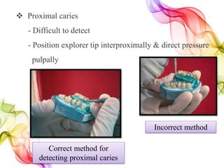 Hard Tissue examination, Diag & trtmnt plan.pptx