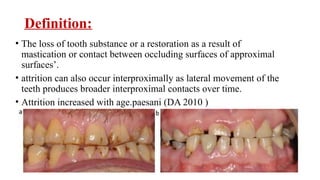 hard tissue tooth loss etiology managment and prevention -sana.pptx