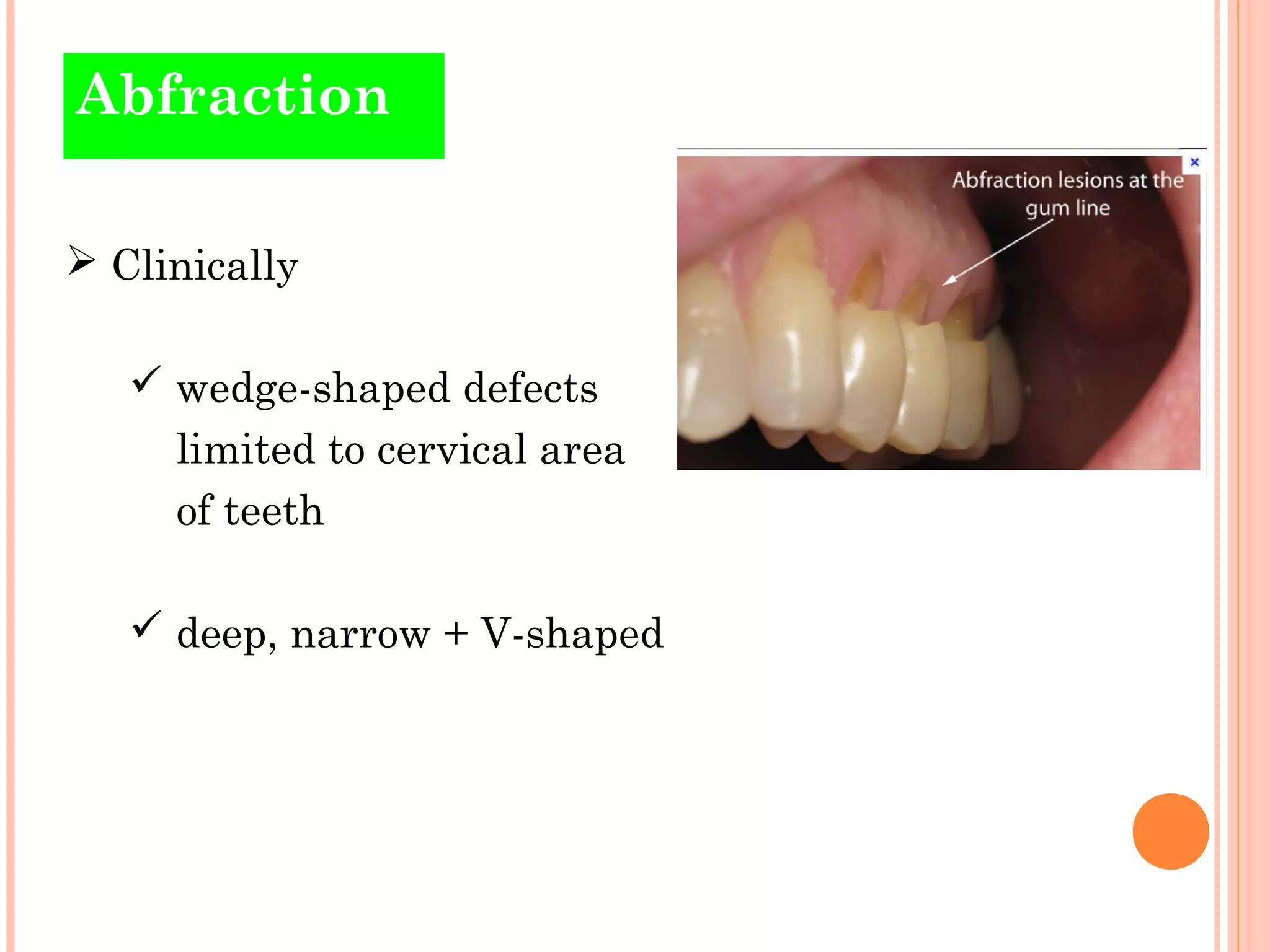 Hard Tooth Tissue Reduction | PPT
