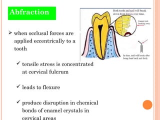 Hard Tooth Tissue Reduction | PPT