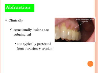 Hard Tooth Tissue Reduction | PPT