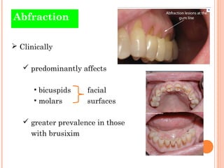 Hard Tooth Tissue Reduction | PPT