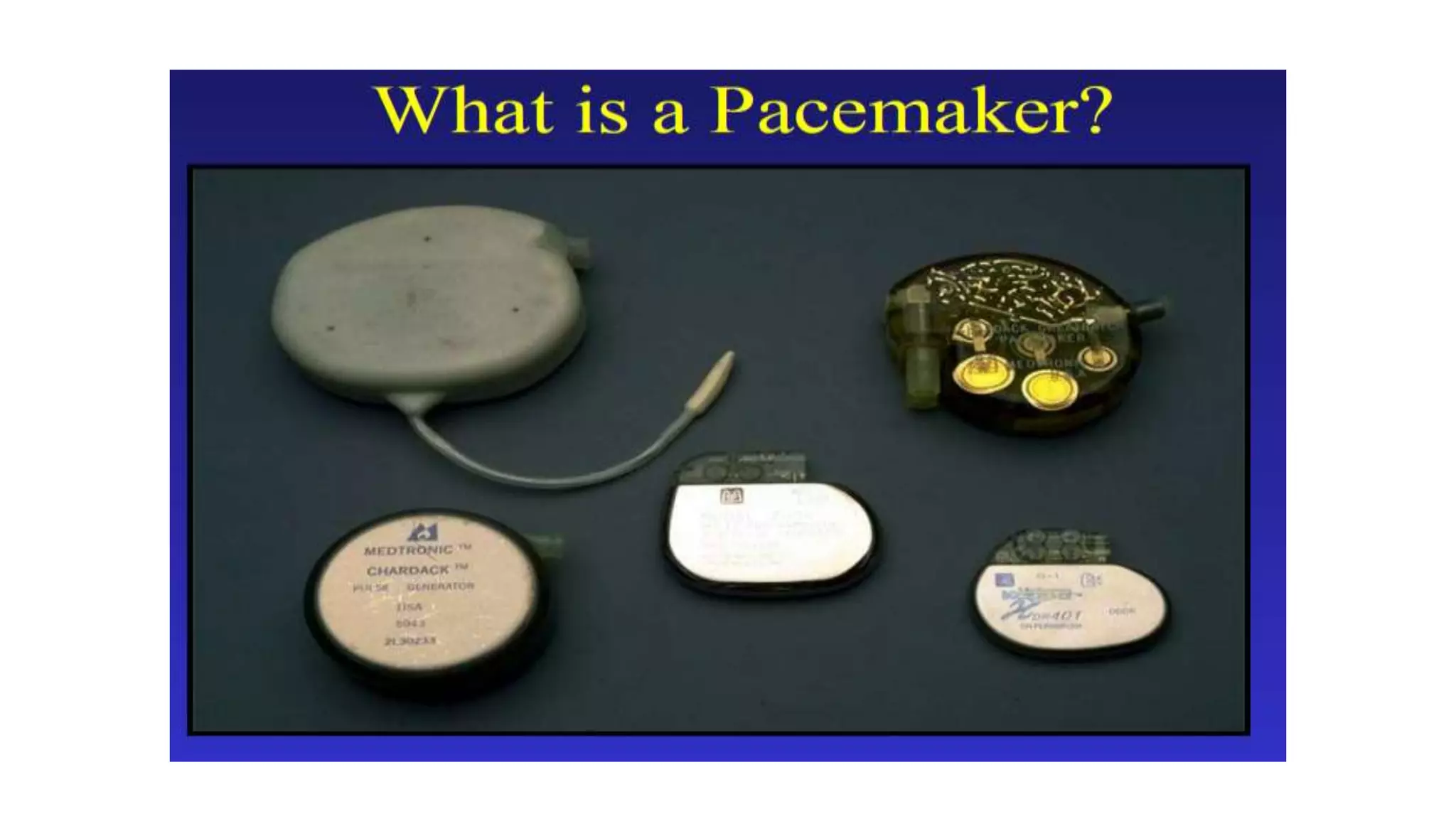 Components of Pacemaker and ICDs - understanding the hardware | PPTX ...
