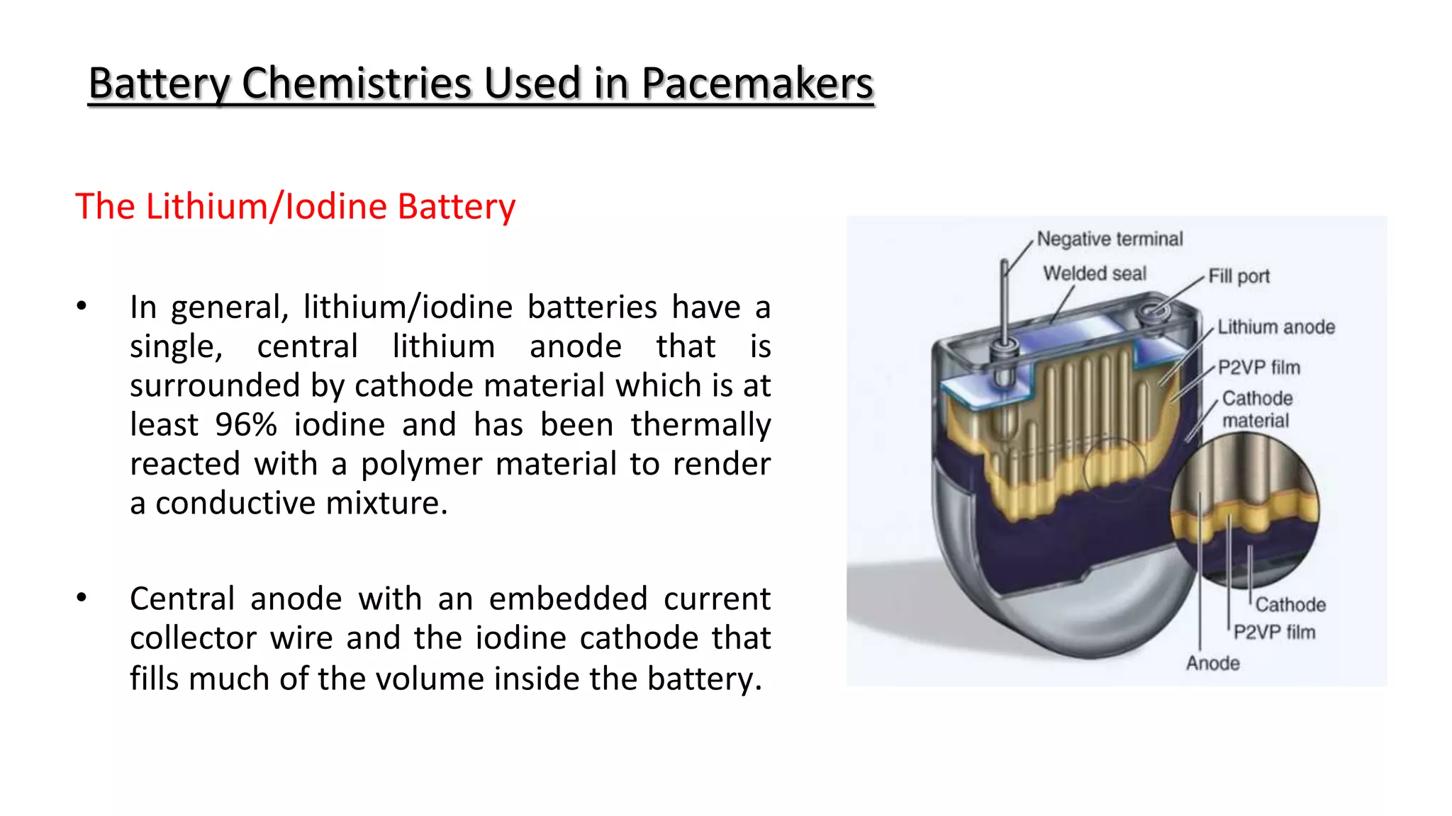 Components of Pacemaker and ICDs - understanding the hardware | PPTX ...