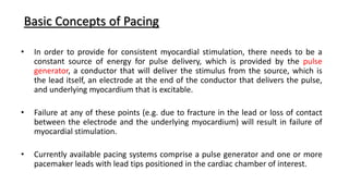 Components of Pacemaker and ICDs - understanding the hardware | PPTX