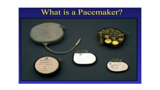 Components of Pacemaker and ICDs - understanding the hardware | PPTX
