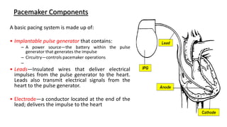 Components of Pacemaker and ICDs - understanding the hardware | PPTX