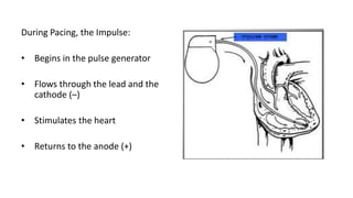 Components of Pacemaker and ICDs - understanding the hardware | PPTX