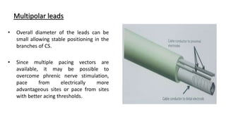 Components of Pacemaker and ICDs - understanding the hardware | PPTX
