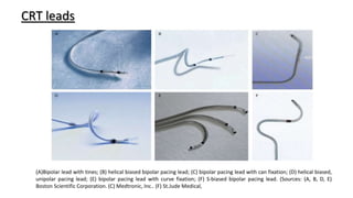 Components of Pacemaker and ICDs - understanding the hardware | PPTX