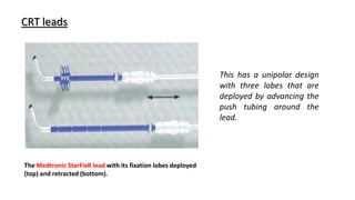 Components of Pacemaker and ICDs - understanding the hardware | PPTX