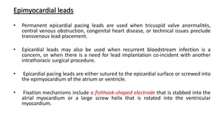 Components of Pacemaker and ICDs - understanding the hardware | PPTX