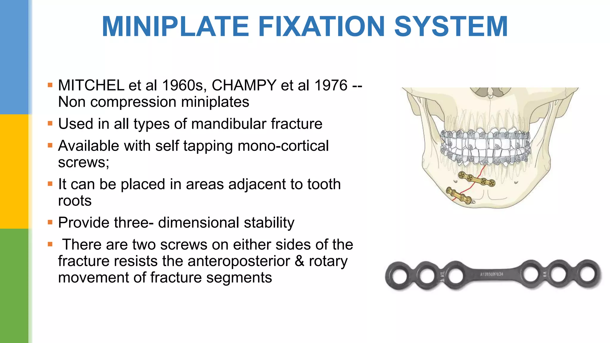 Hardware in maxillofacial trauma | PPTX