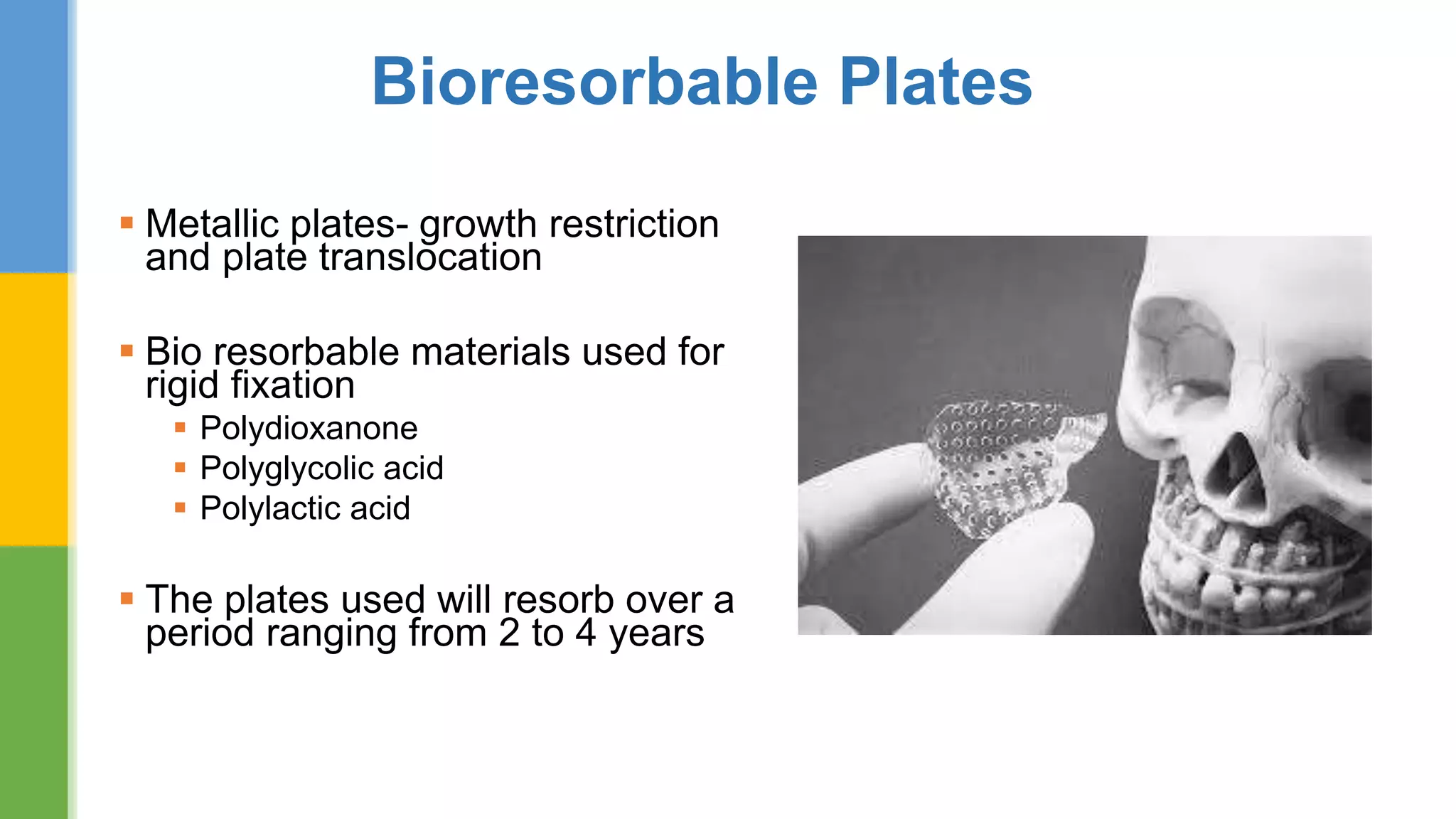 Hardware in maxillofacial trauma | PPTX