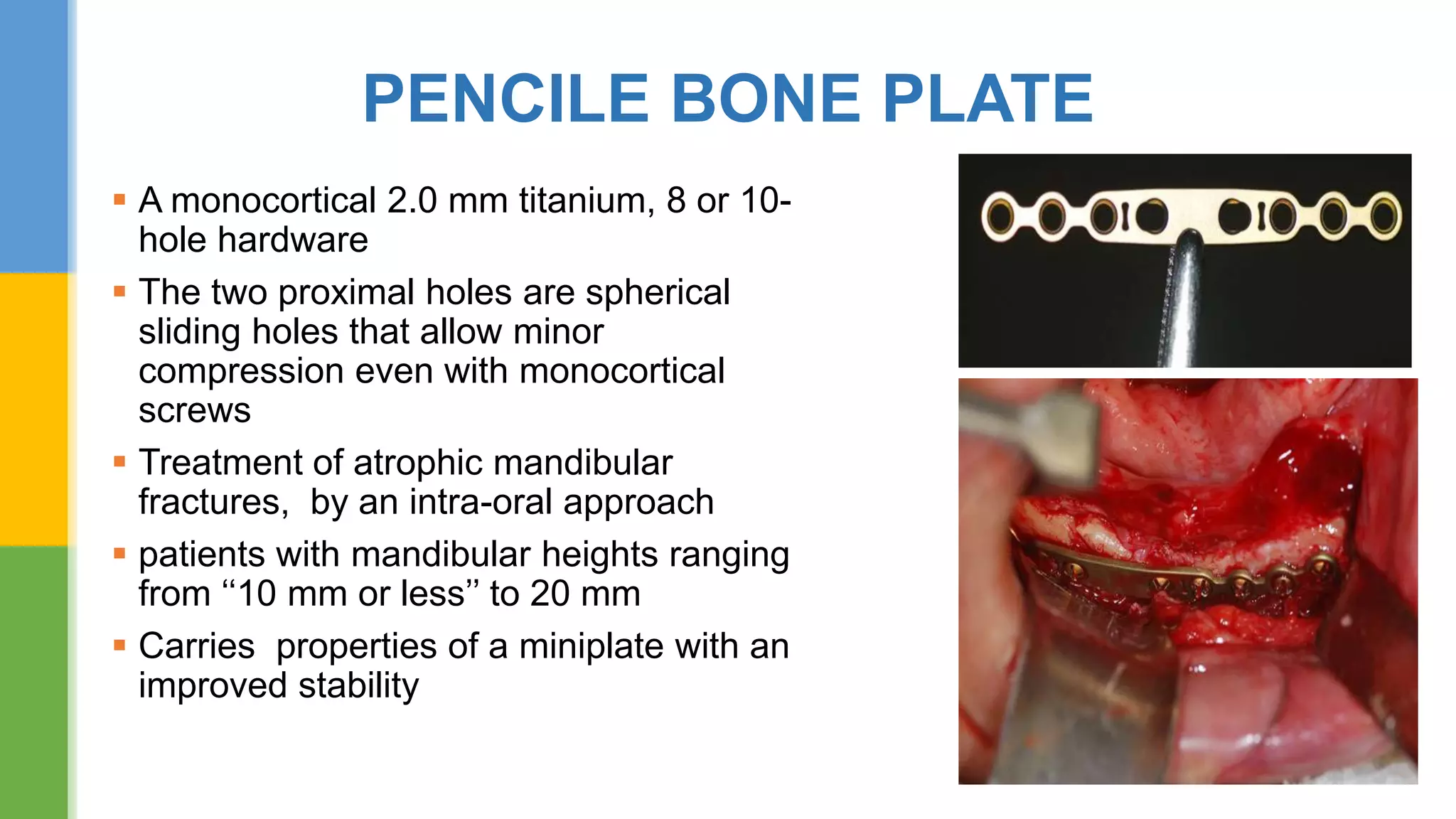 Hardware in maxillofacial trauma | PPTX