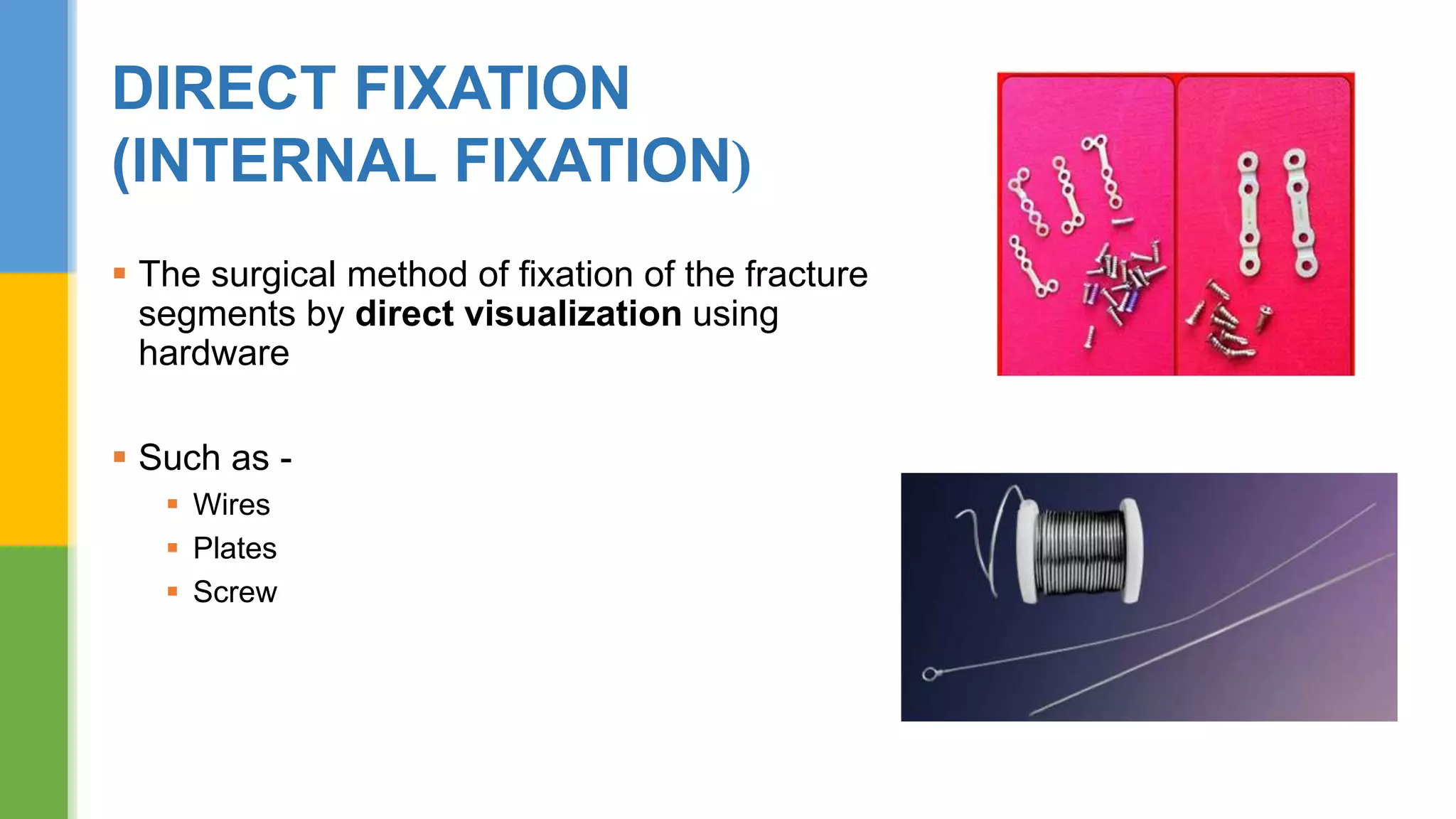 Hardware in maxillofacial trauma | PPTX