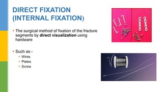 Hardware in maxillofacial trauma | PPTX