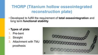 Hardware in maxillofacial trauma | PPTX