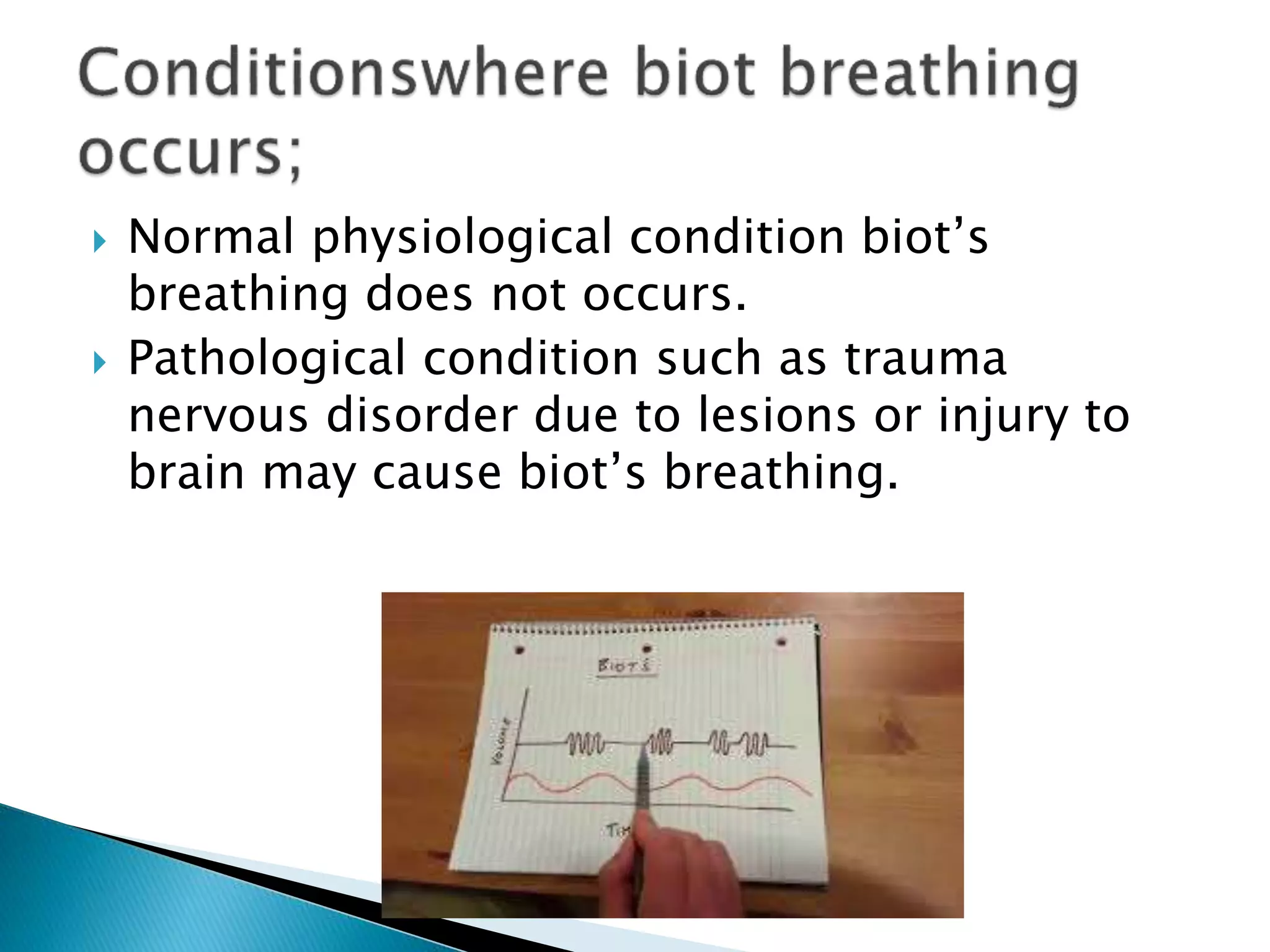periodic breathing | PPTX