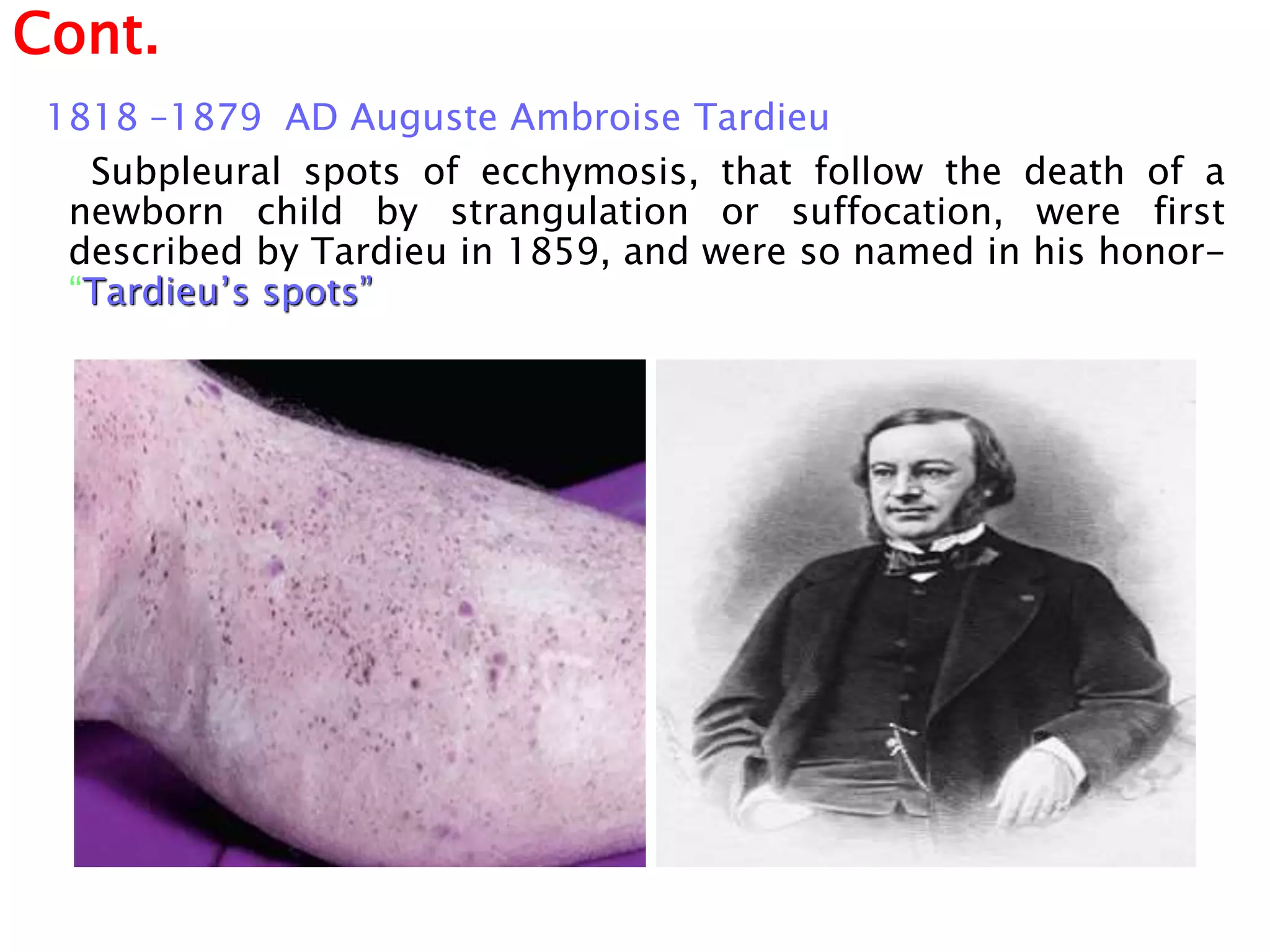 History of forensic medicine . Dr. Haricharan MD RIMS Imphal . MBBS ...